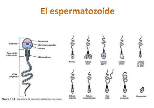 TODOS los tipos de espermatozoides: morfología y movimiento - ¡RESUMEN!