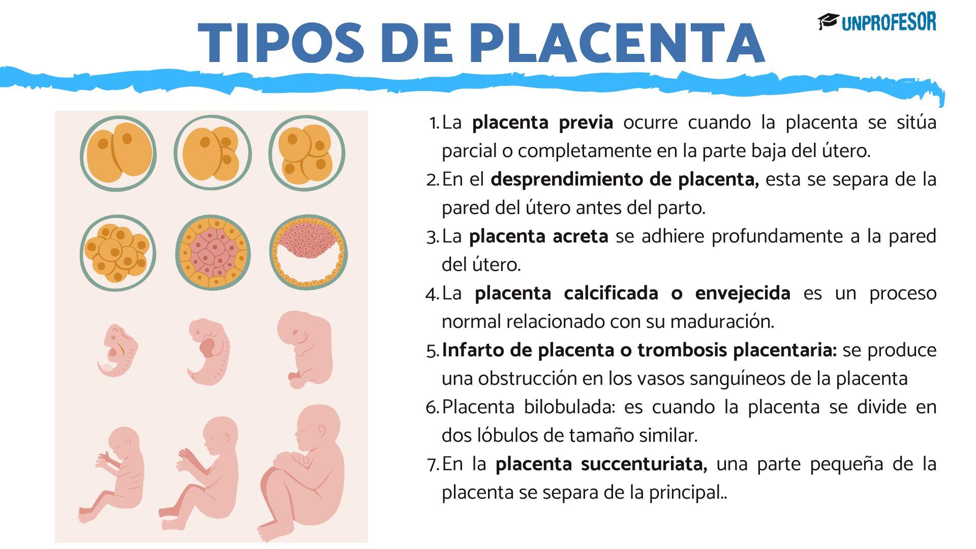 7 tipos de PLACENTA en el embarazo